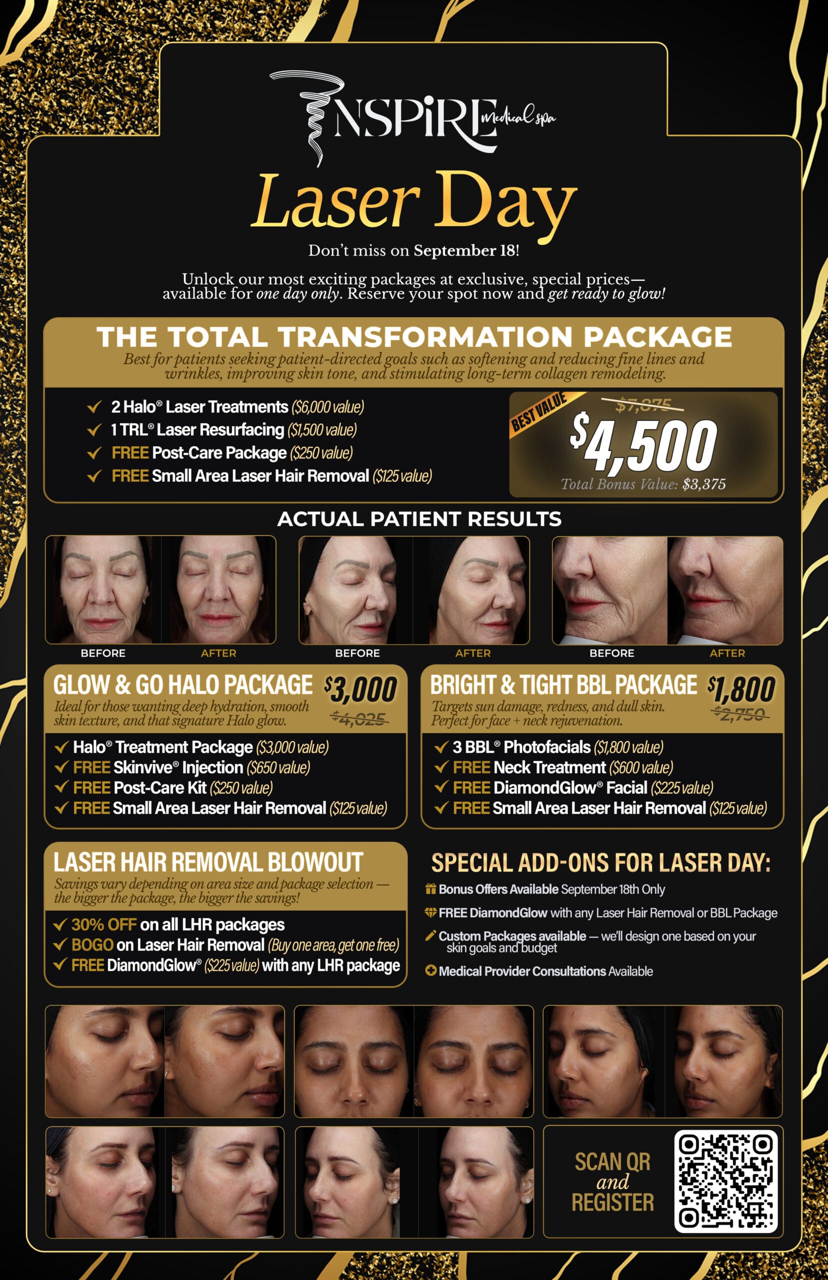 Laser Day 2025 - INSPIRE MEDICAL SPA